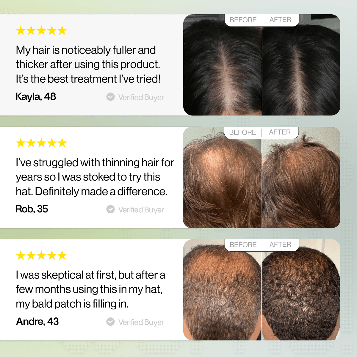 Red Light Therapy Hair Growth Cap | LED Esthetics