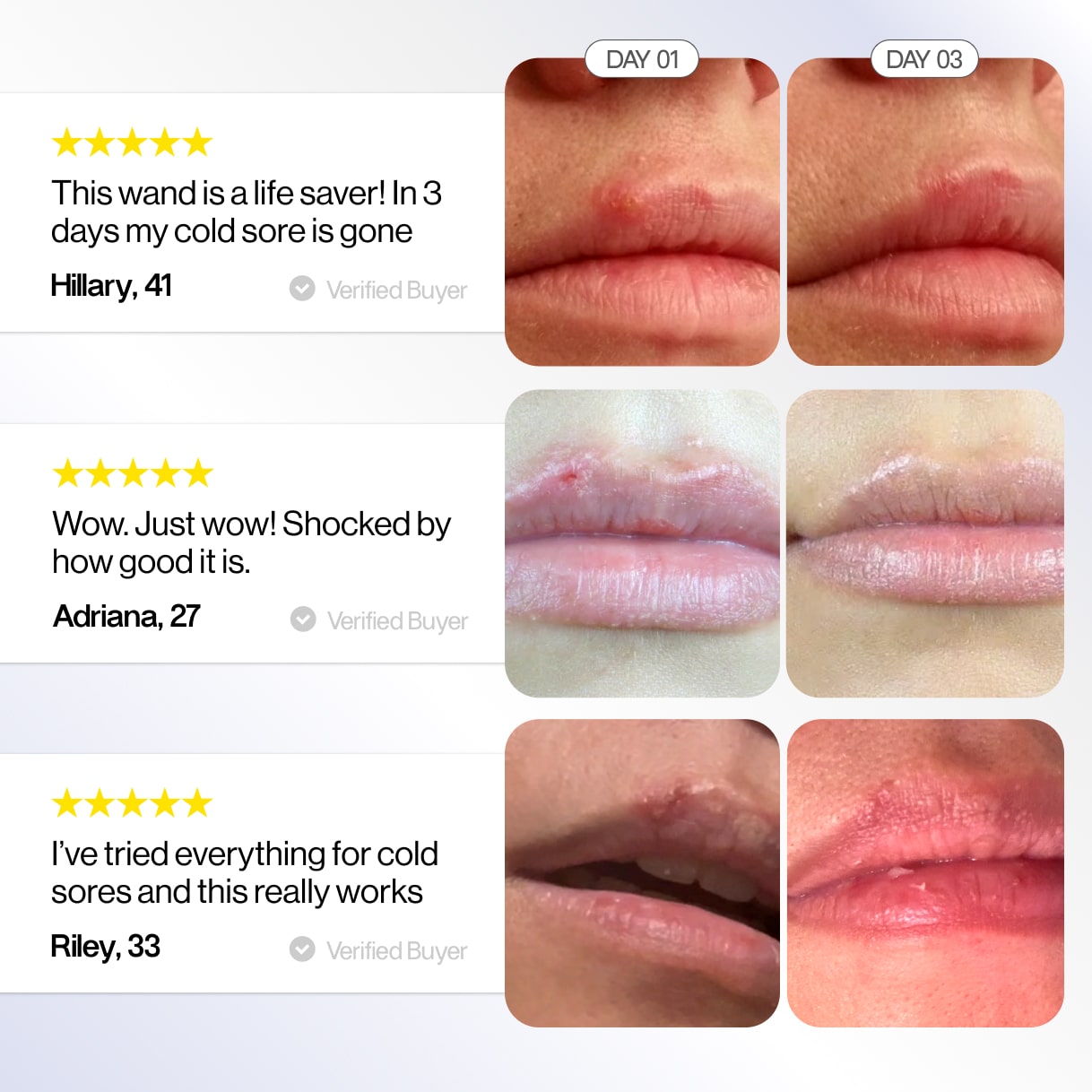 Glotech™ Lip Infrared Light Therapy Wand | LED Esthetics