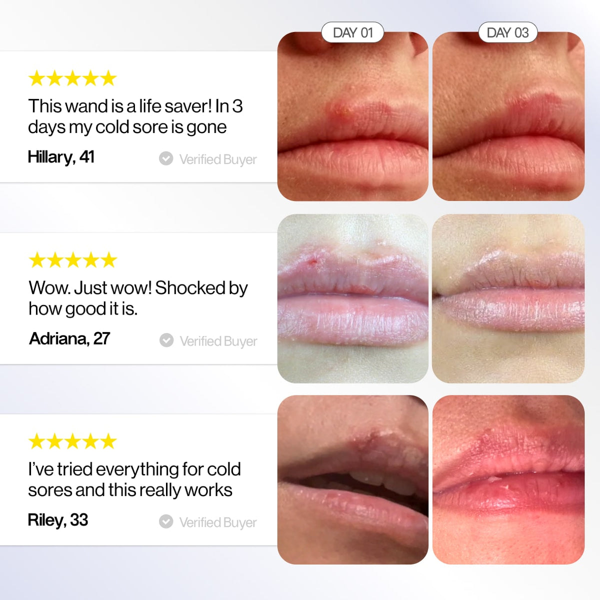 Glotech™ Lip Infrared Light Therapy Wand | LED Esthetics