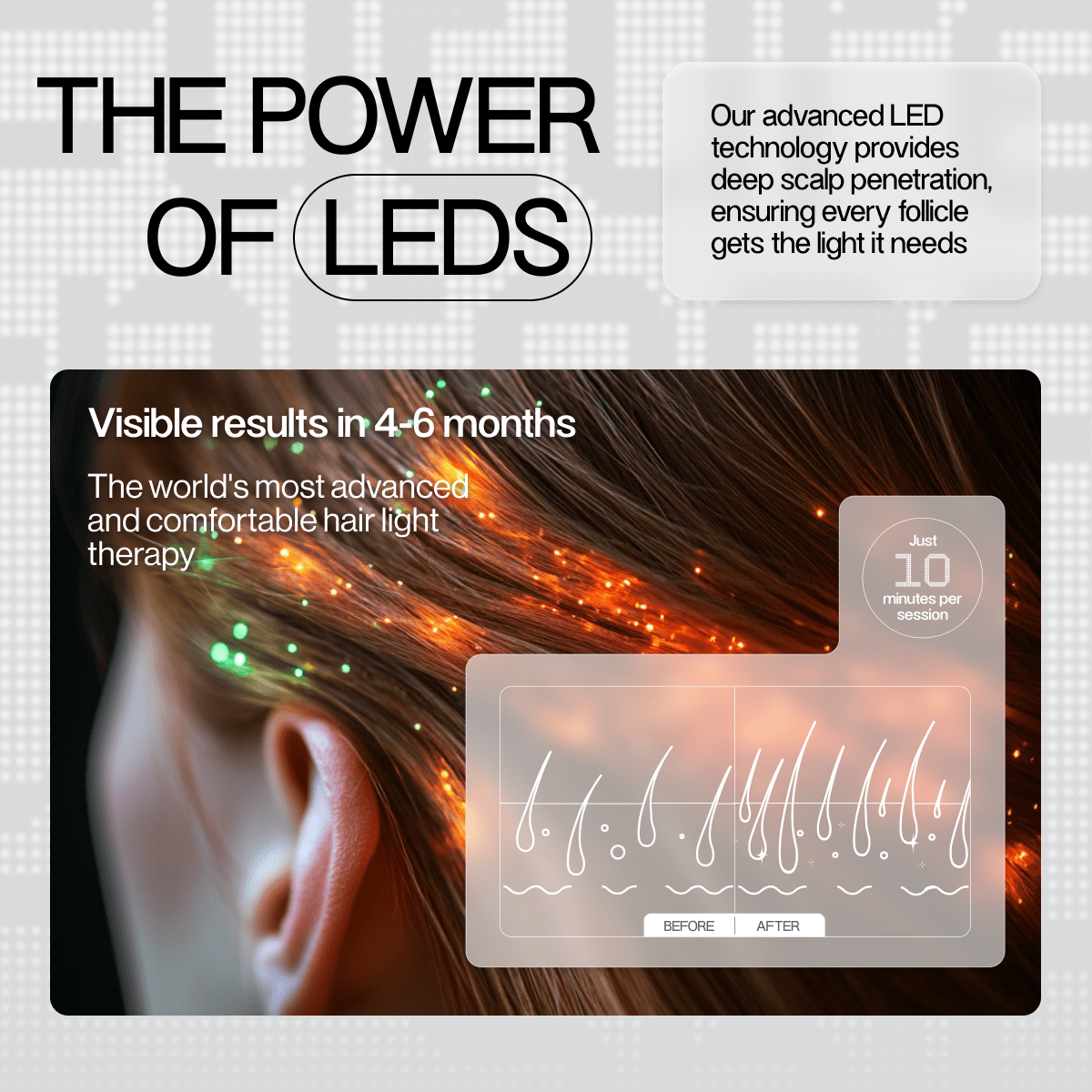 Red Light Therapy Hair Growth Cap | LED Esthetics