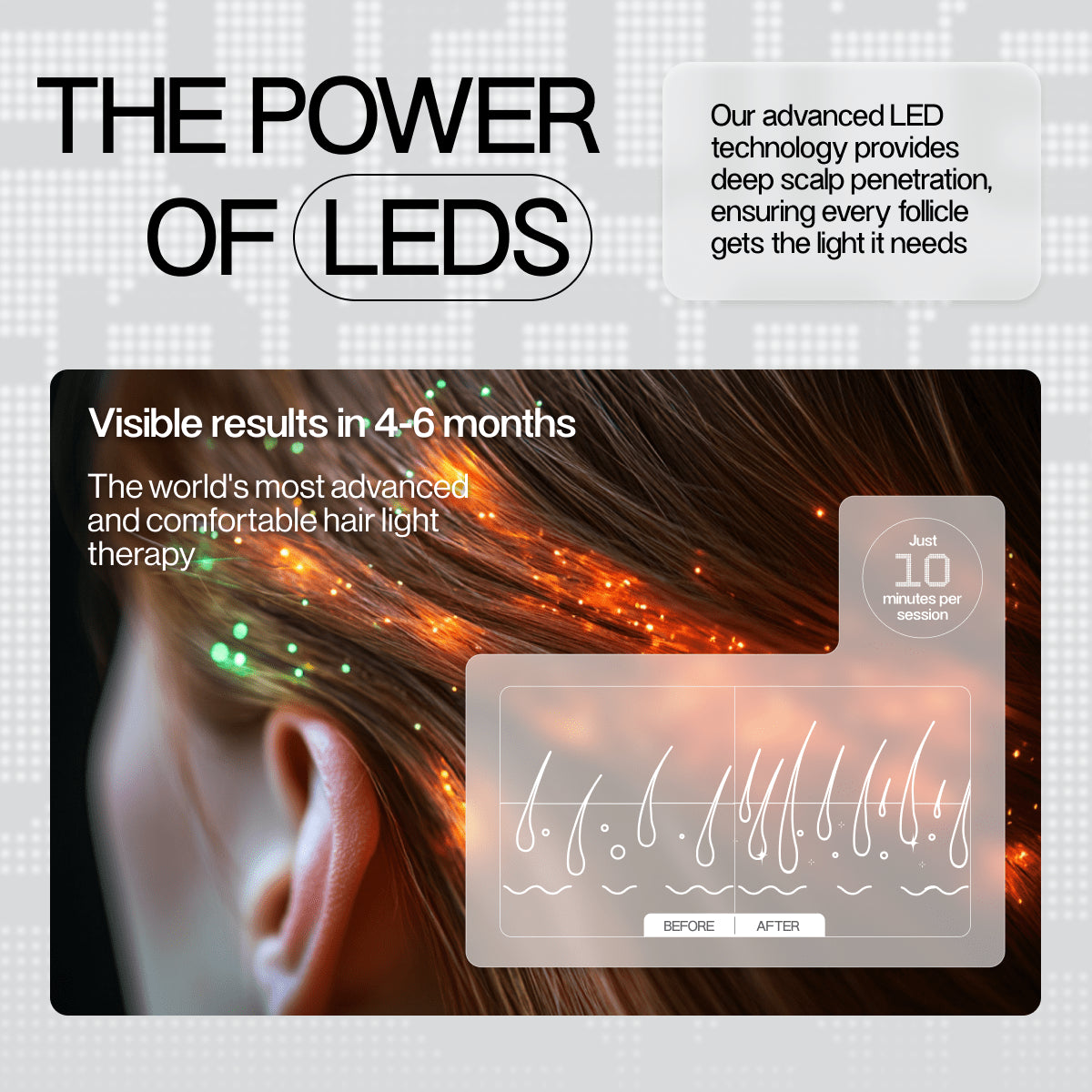 Red Light Therapy Hair Growth Cap | LED Esthetics